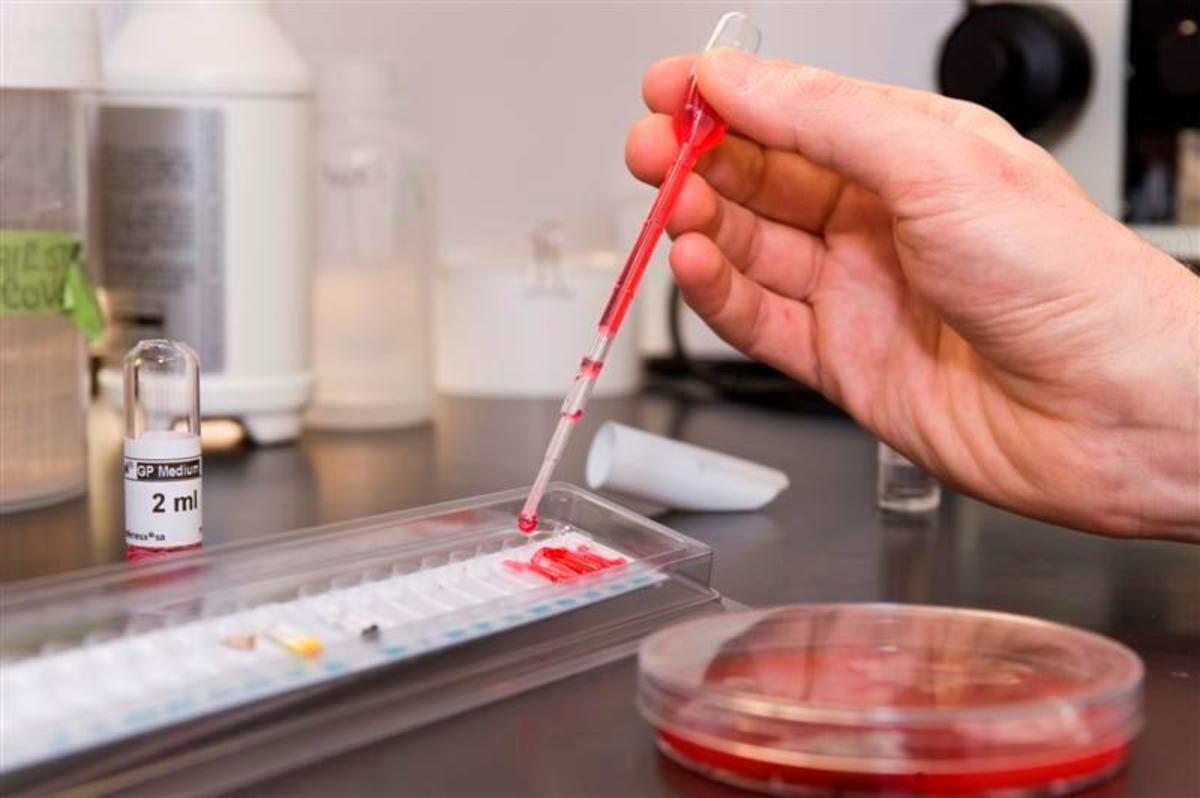 Τι να μην κάνω πριν τις μικροβιολογικές εξετάσεις!