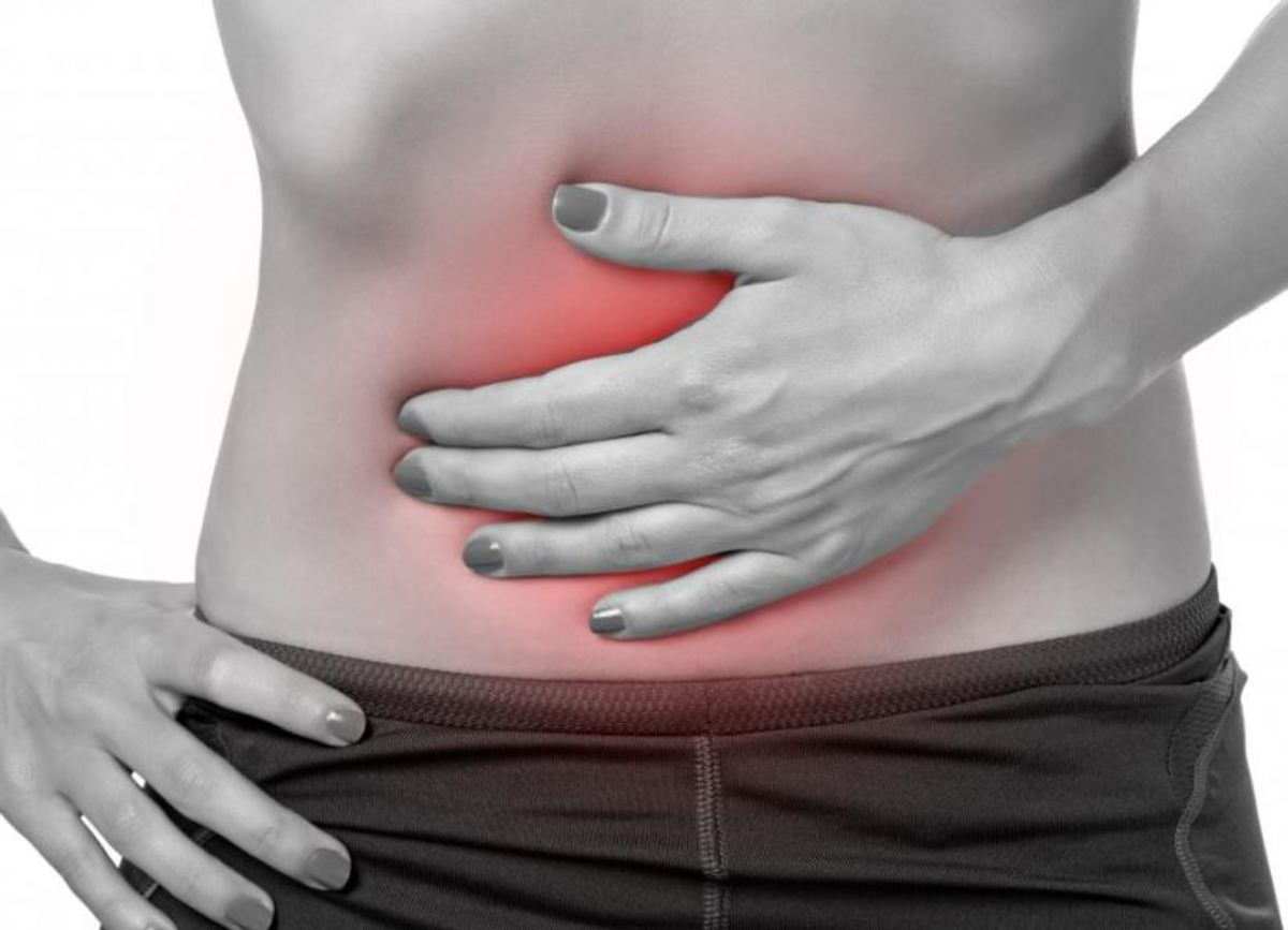 Κήλη: Τι είναι, αίτια, θεραπεία και χειρουργική επέμβαση