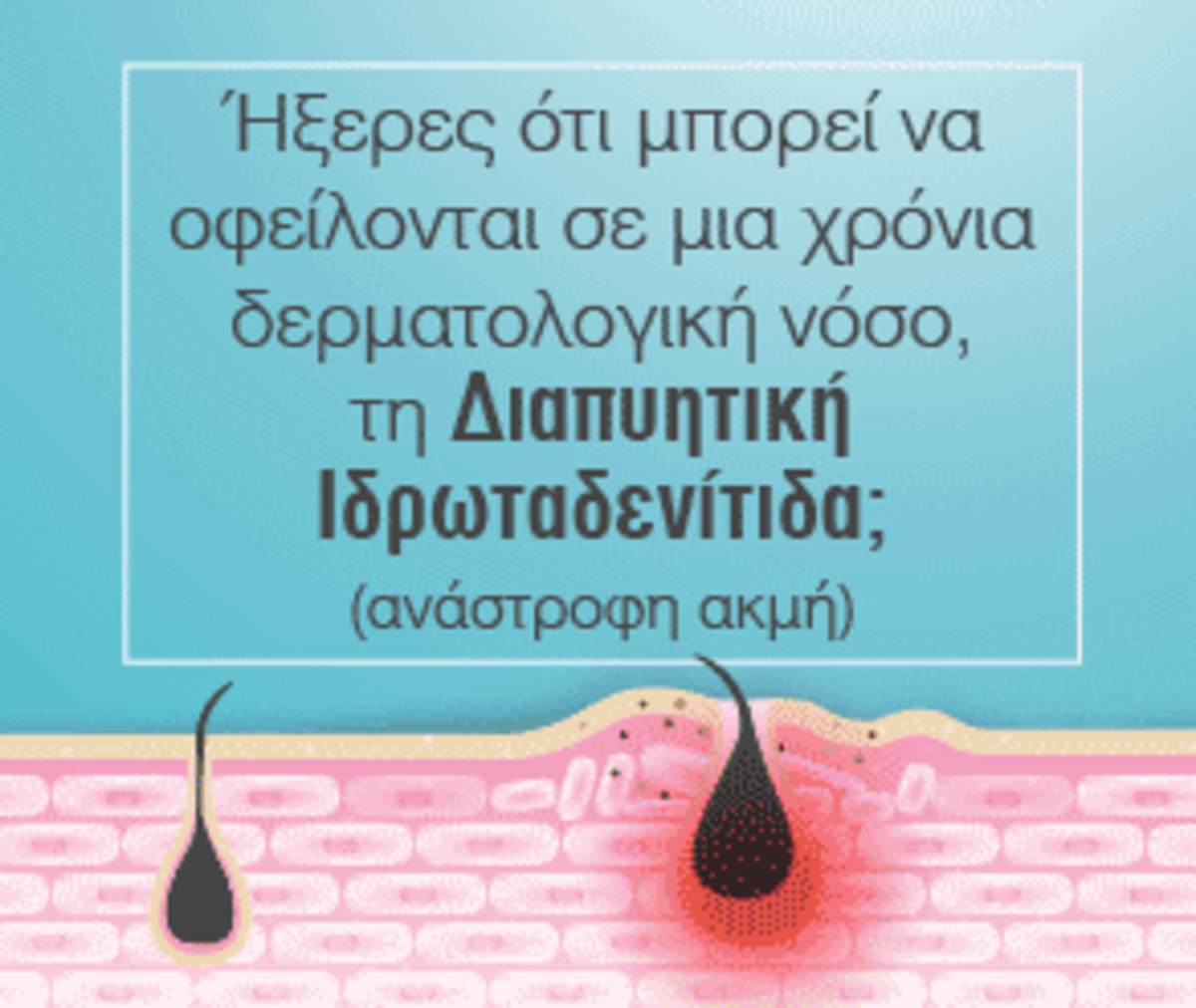 Έρευνα για τη διαπυητική ιδρωταδενίτιδα από την Β΄Πανεπιστημιακή ...