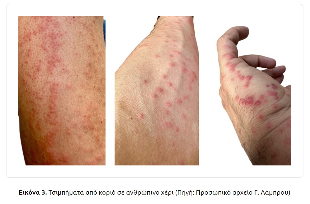 Κοριοί: Τι είναι, πού βρίσκονται, πόσο κινδυνεύουμε