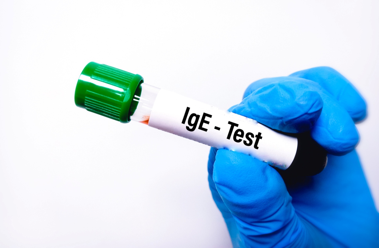 Ανοσοσφαιρίνη IgE: Η ουσία στο αίμα που δείχνει αν έχετε αλλεργία