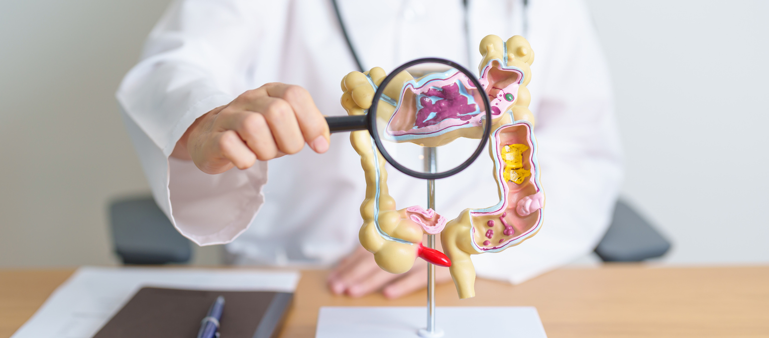 Νόσος του Crohn: Επιστήμονες ανέπτυξαν «μίνι έντερα» για να βοηθήσουν ...