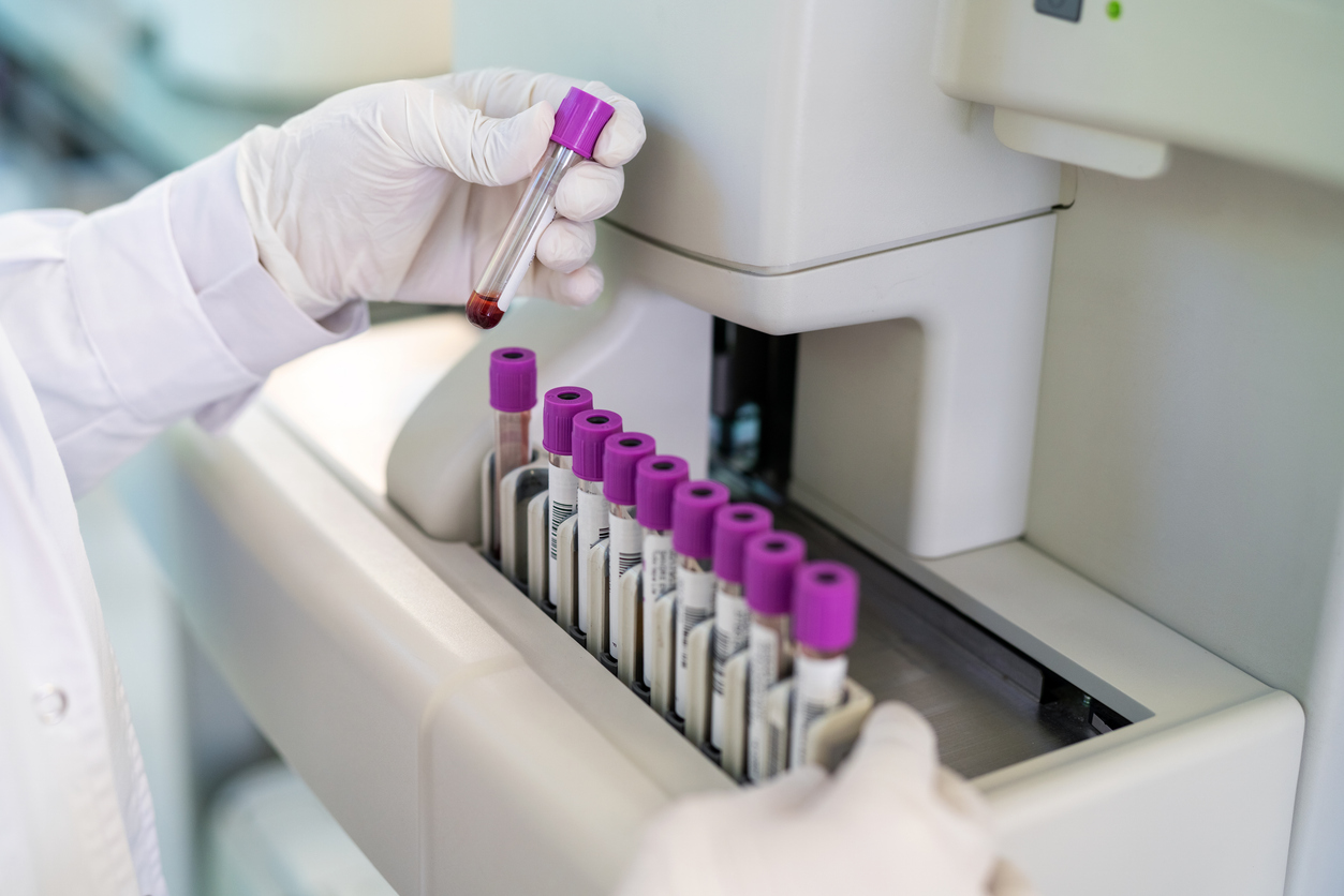 Νέα εξέταση αίματος RNA ανιχνεύει τον καρκίνο και παρακολουθεί την ...