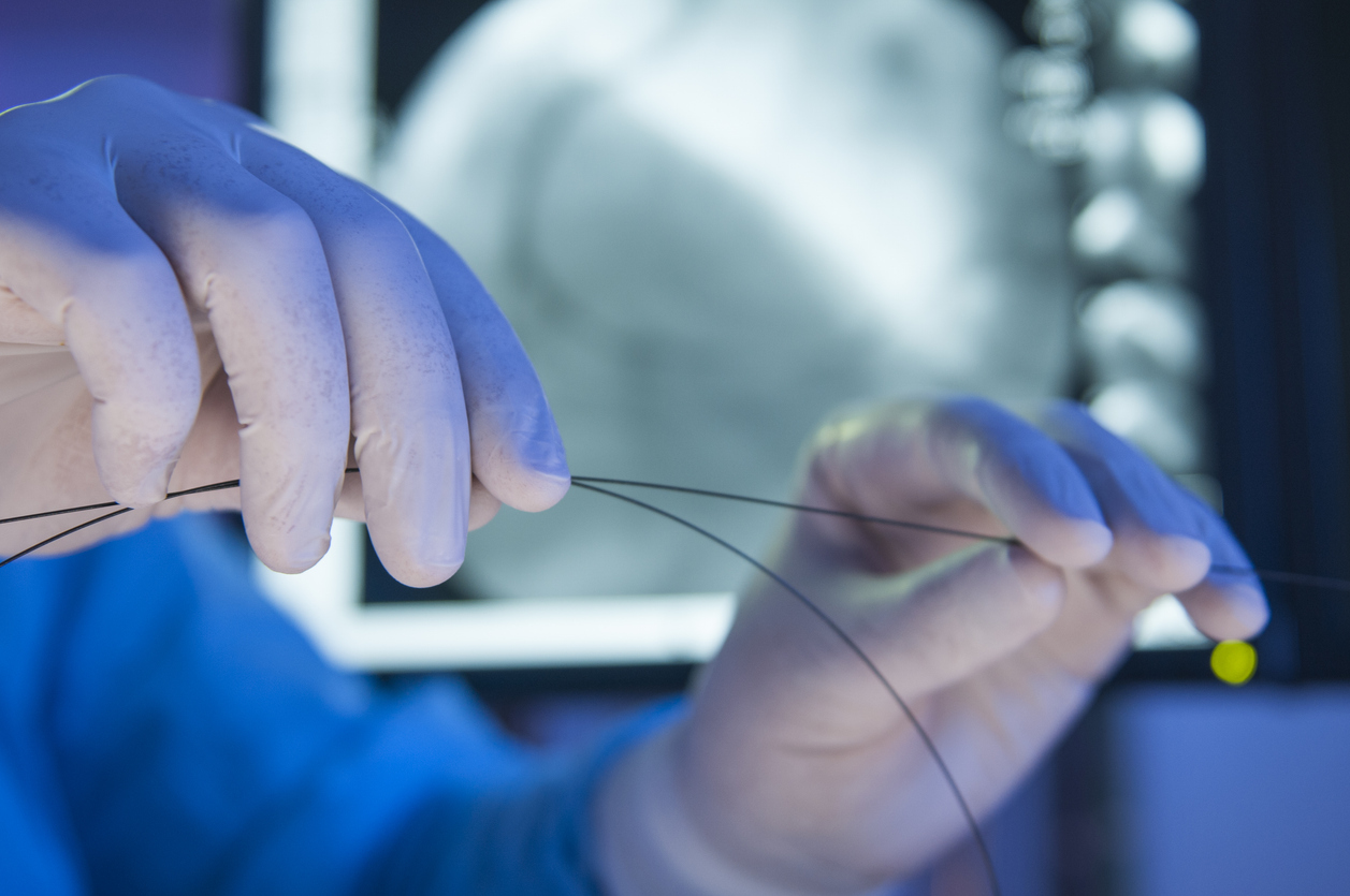 Πότε μπορεί να χρειαστεί κανείς στεντ (stent) και πότε δεν συνιστάται η ...