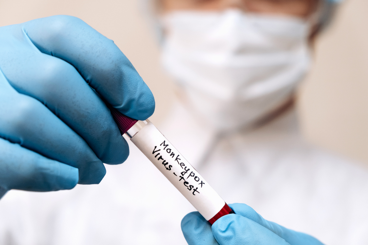 Νόσος mpox: Συναγερμός στην Ευρώπη για το επικίνδυνο στέλεχος της ...