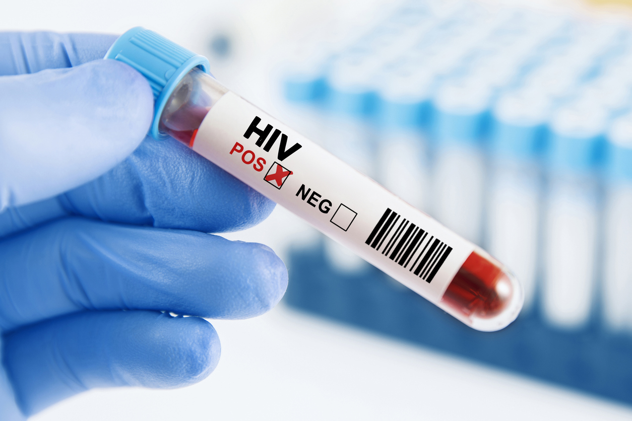 HIV/AIDS: Πάνω από τις μισές διαγνώσεις στην Ελλάδα γίνονται ...
